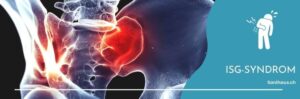 ISG-Syndrom - Beschwerden bei Blockade & Reizung lindern